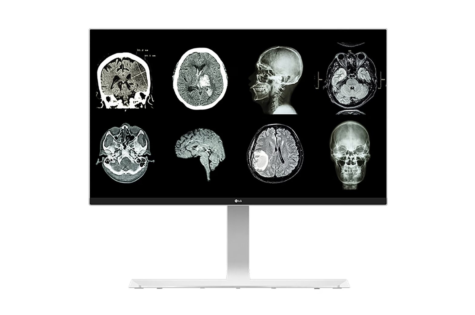 Monitor de revisión clínica LG 27″ 8MP 27HJ712C – GAPMEDICAL Chile ...